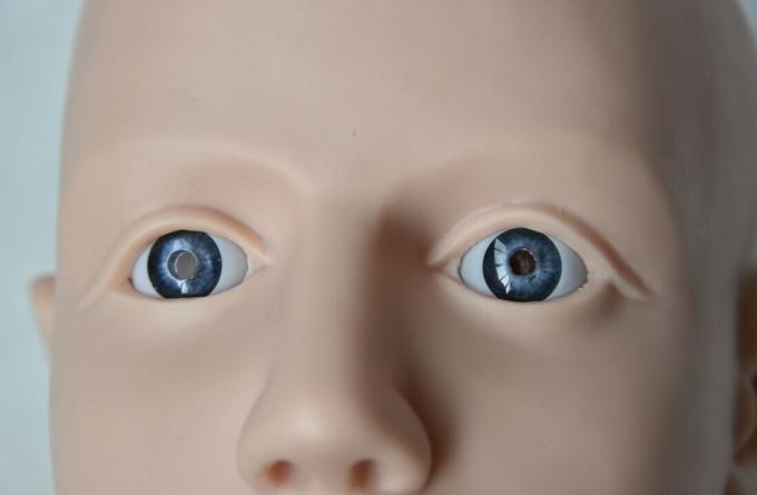 Modelo de entrenamiento clínico de las enfermedades del eyeground de la ...